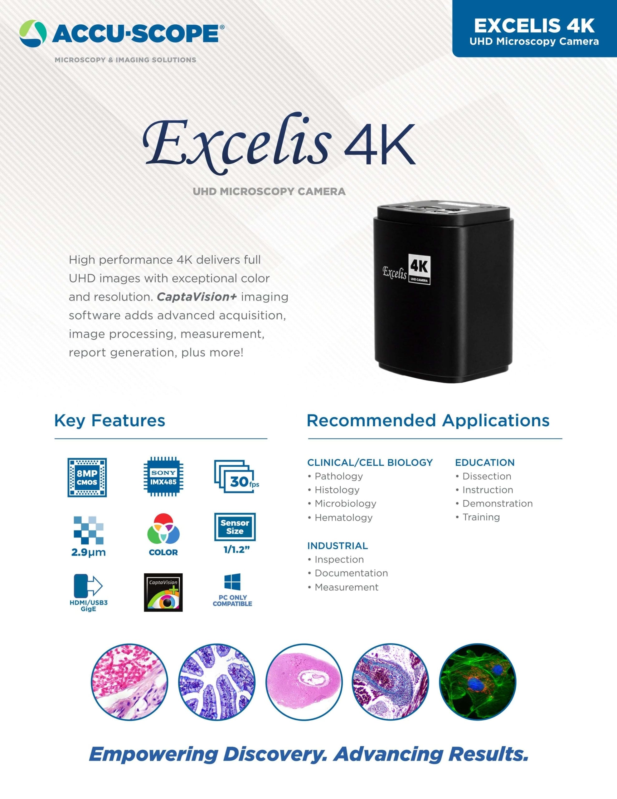 EXCELIS™ 4K - Accu-Scope